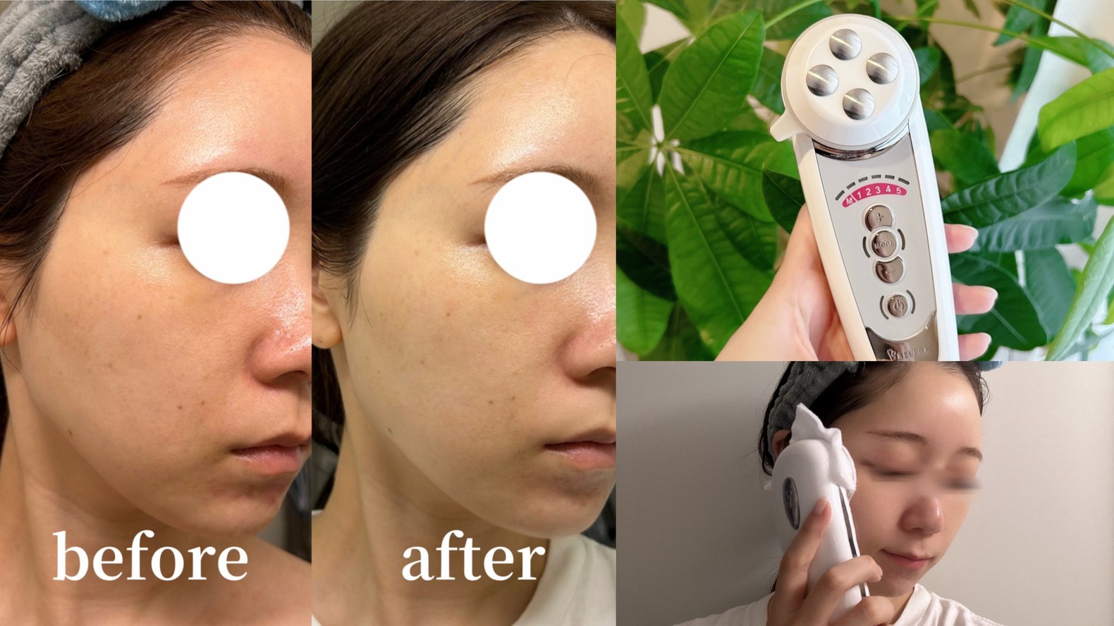 MEGUMIさん愛用で話題！セルキュアの美顔器って本当に効果あるの？使い方や1週間ライターが試したbefore/afterをご紹介 | arweb（アールウェブ）